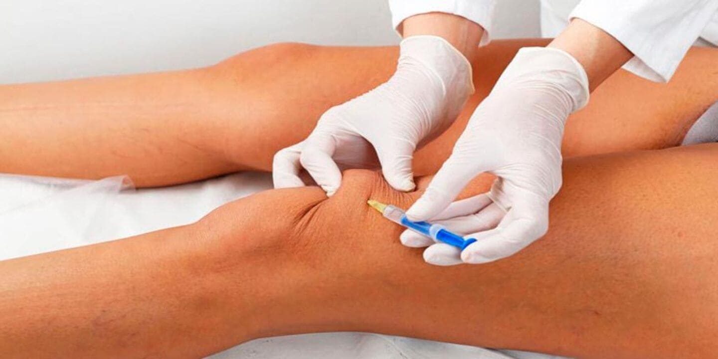 Plasma rico en plaquetas corporal - BertiSpa